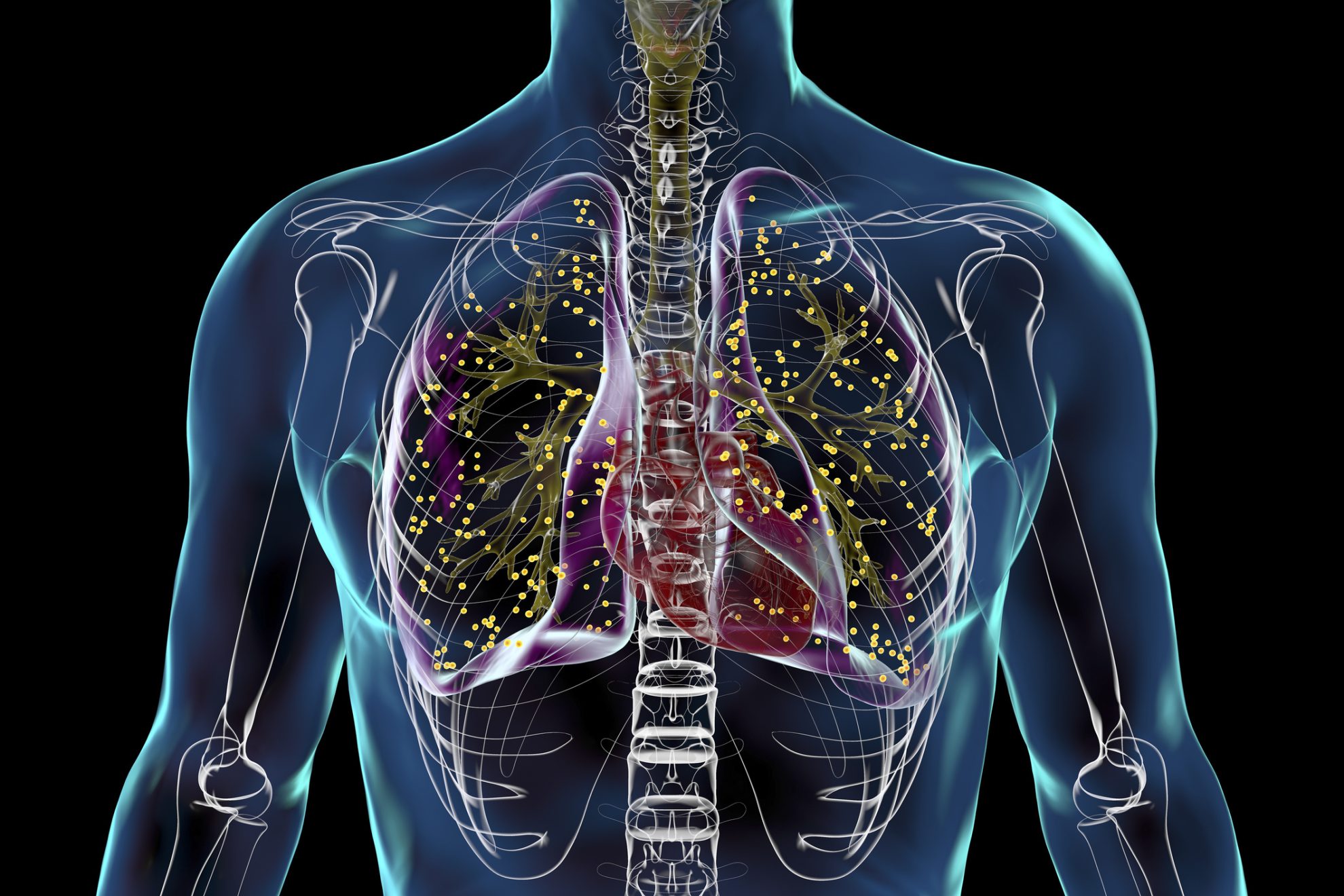 India records 21% decline in TB incidence, nearly double global rate ...